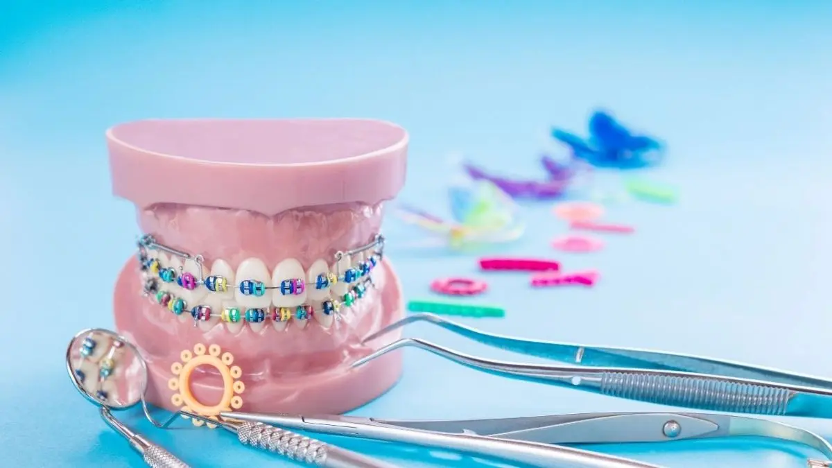 Résorption radiculaire: Causes, Symptômes, Traitement • SoinDentaire
